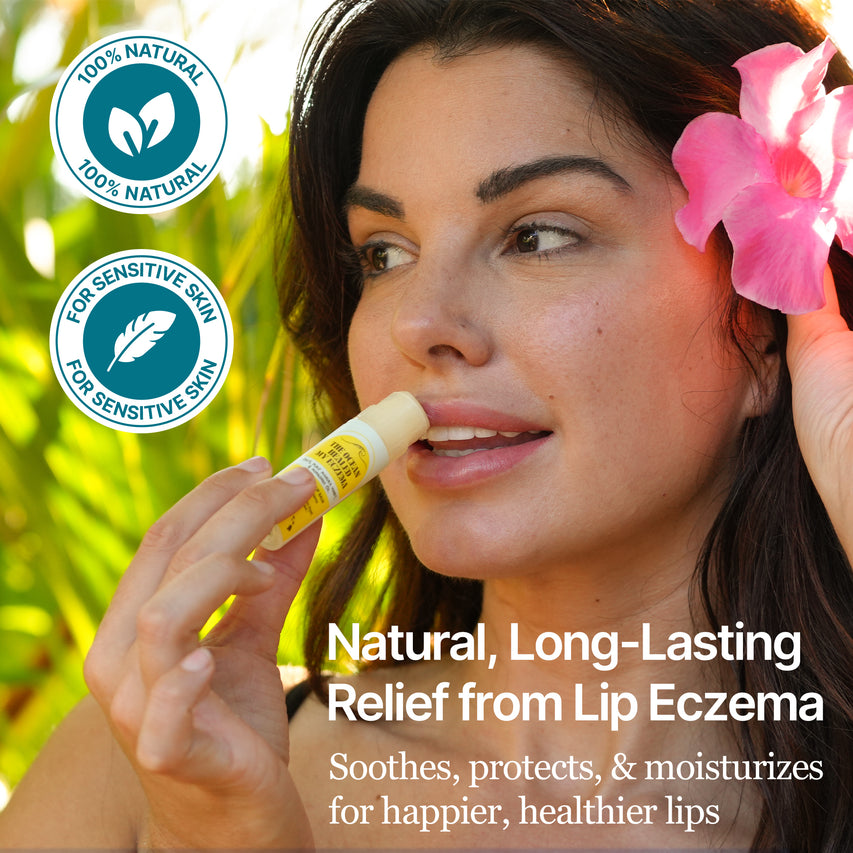The Ocean Healed My Eczema™ - Mongongo Lip Balm – HealedByTheOcean
